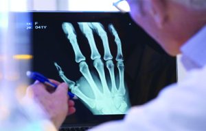 Osteoporosis Treatment In Dubai - Dr. Robert Hierner