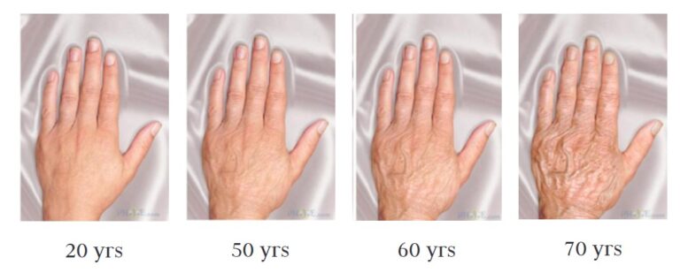 Signs Of Aging Hands And How To Treat Them